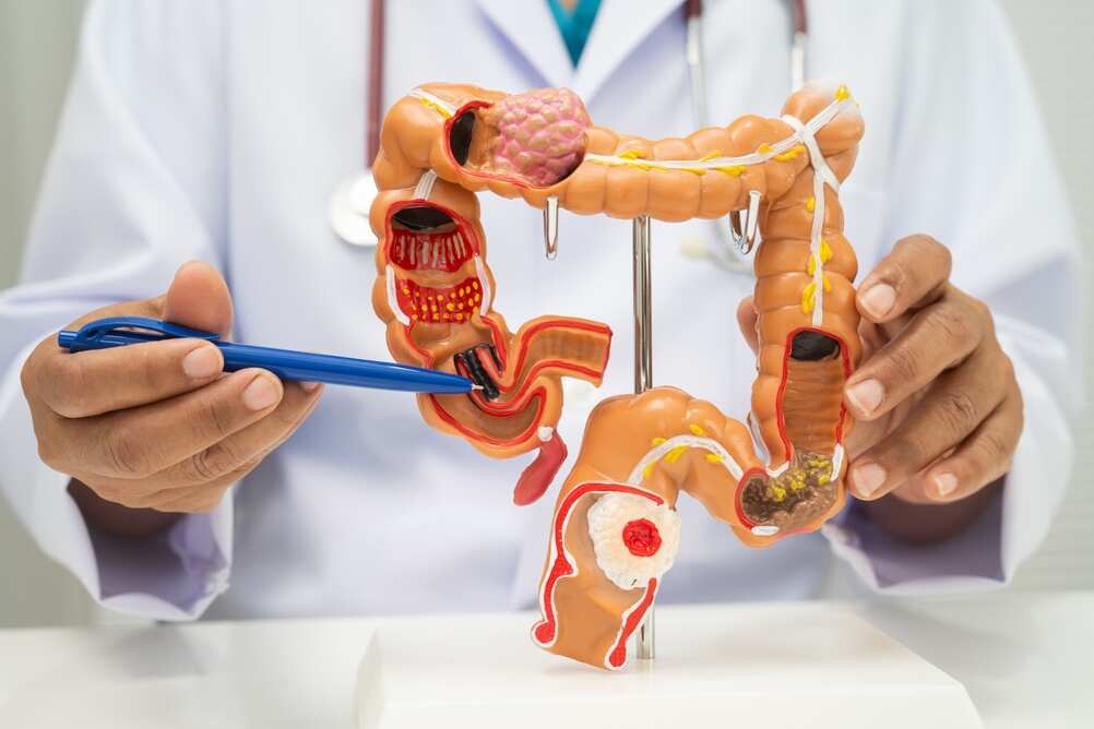Colon Cancer Explodes Under 50 | Straight Shooter News
